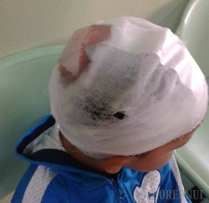 Când doi se ceartă, al treilea se alege cu capul spart